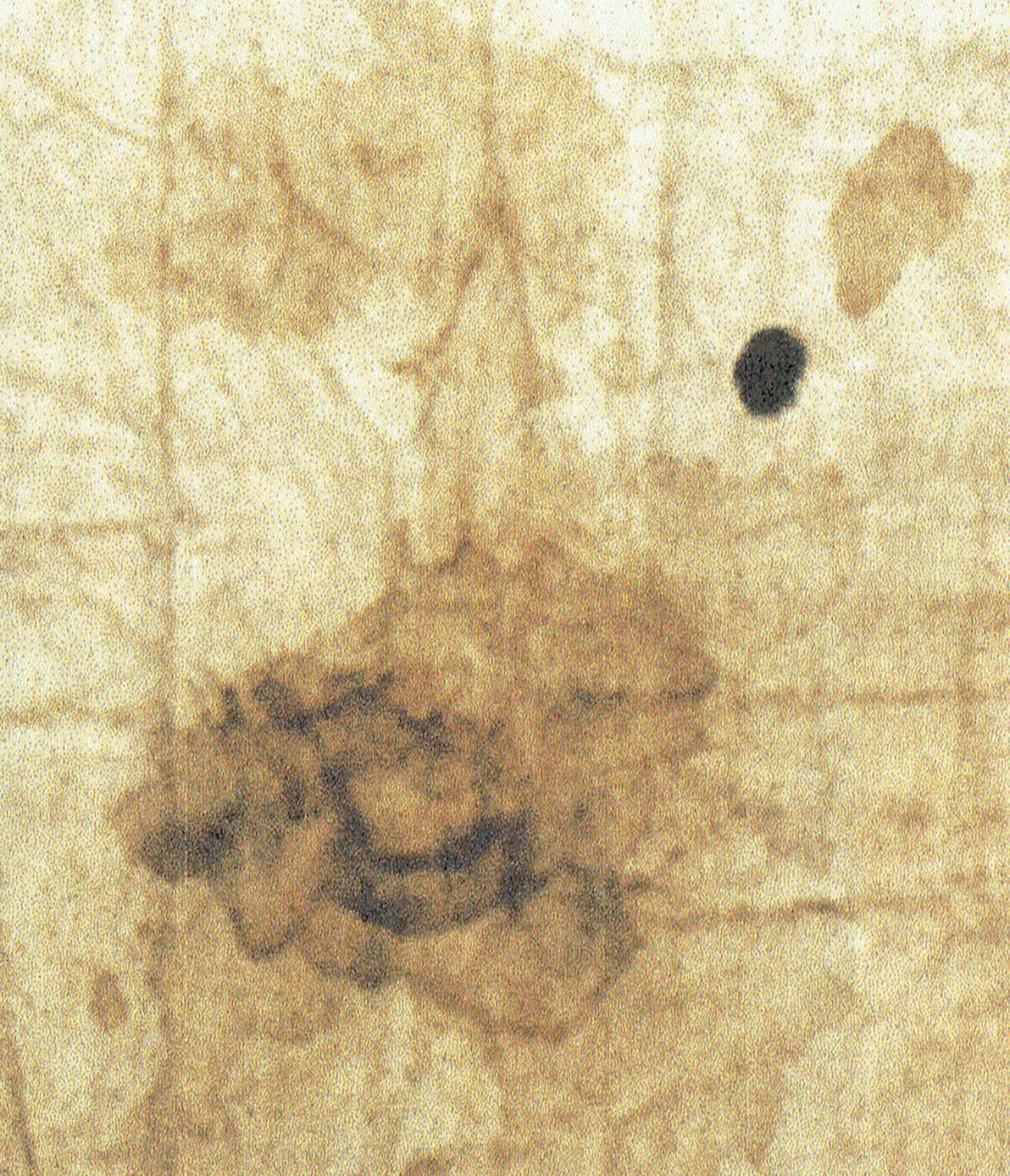 Separated at Birth? – The Medieval Shroud
