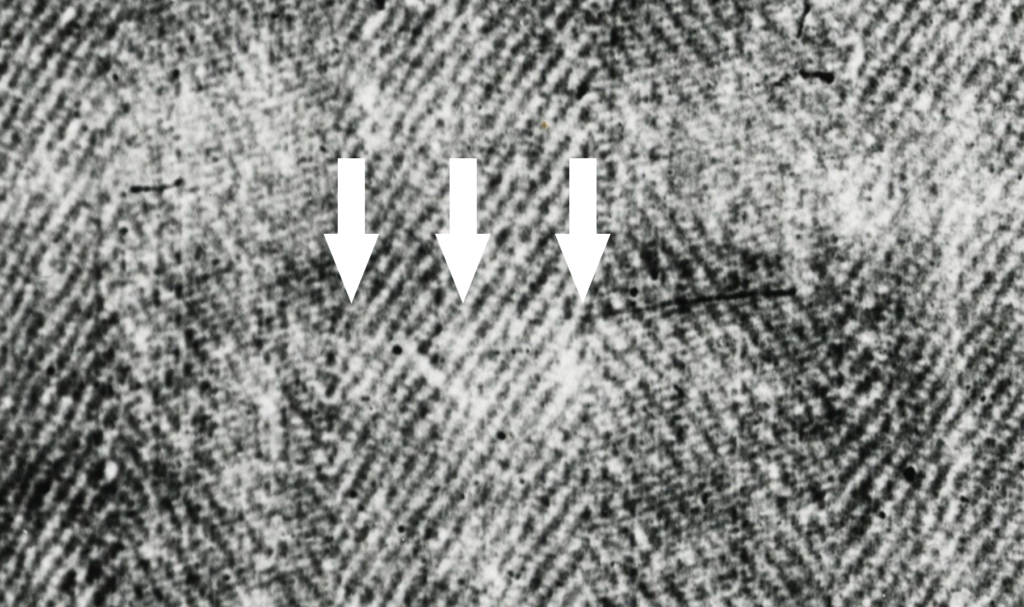 Teeth Revisited – The Medieval Shroud